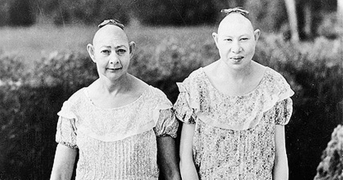 Series Feature #6 – Life in The Circus From Yesterday to Today ...